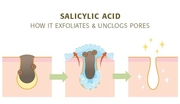 Salicylic Acid - Ingredients Spotlight. - FTT Skin Clinics