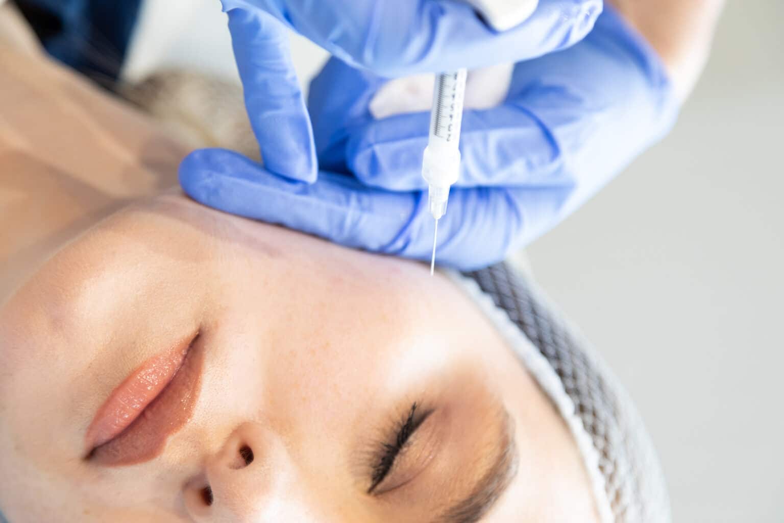 Lanluma Collagen Stimulating Injectable