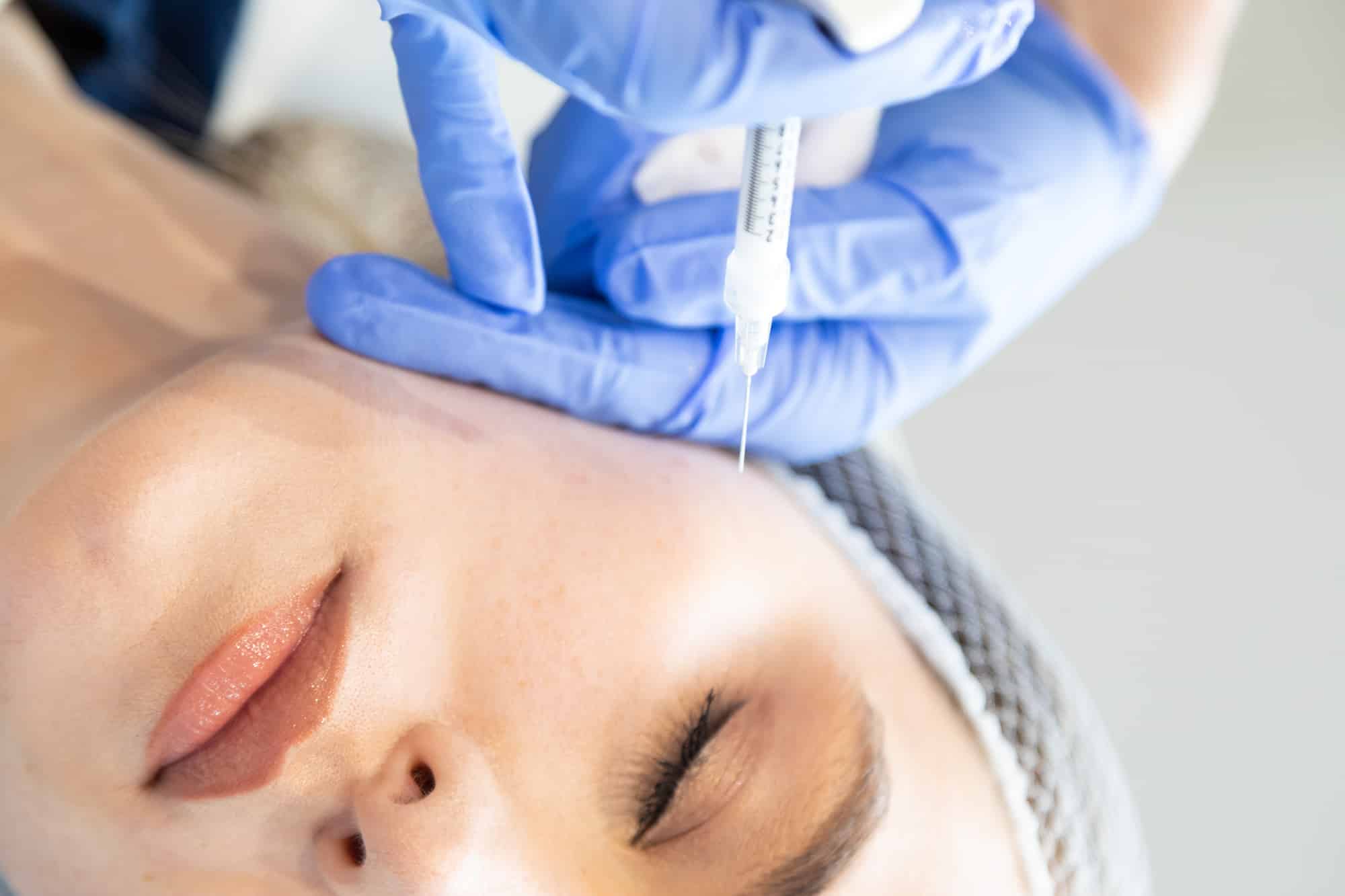 Lanluma Collagen Stimulating Injectable